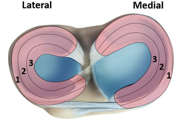 Anatomía Del Menisco – Lesión de menisco: causas, tipos y tratamientos ...